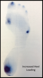 Overload Heel Pain Syndrome - FootEducation