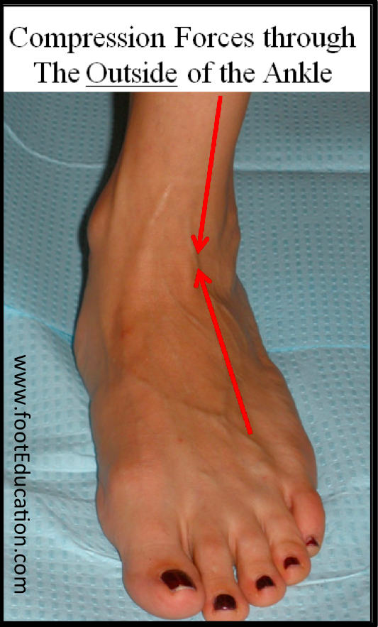 Characteristics of a Flat Foot - FootEducation