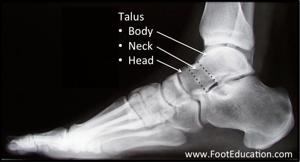 Bones And Joints Of The Foot And Ankle Overview FootEducation Bones And Joints Of The Foot And Ankle Overview FootEducation