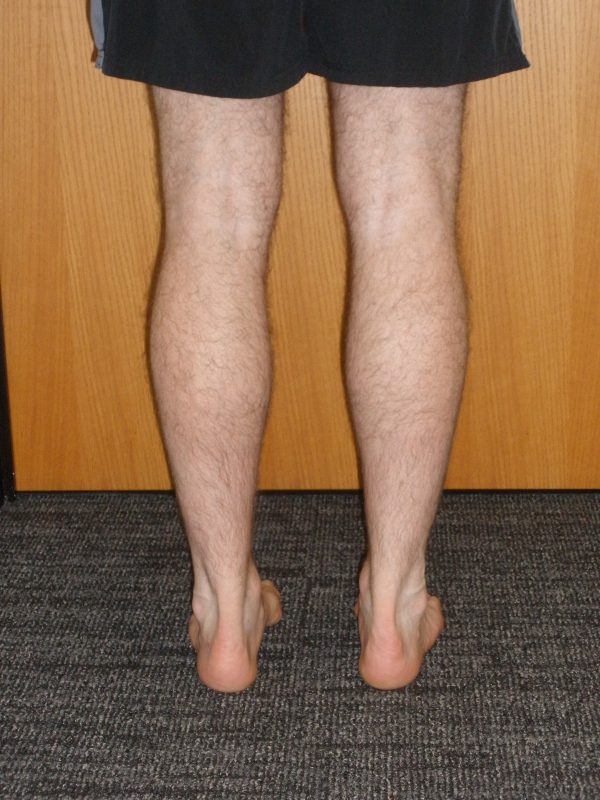 Double Leg Heel Rises - FootEducation