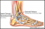Chronic Peroneal Tendon Subluxation - FootEducation