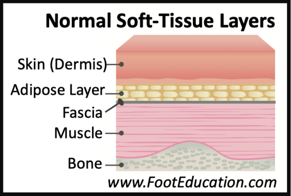 Scar Massage using Soft-Tissue Mobilization or Myofascial Release ...