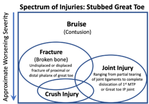 Stubbed Great Toe - FootEducation