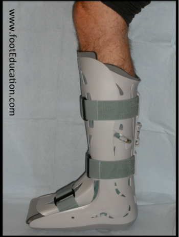 Cam Walker Boot - FootEducation