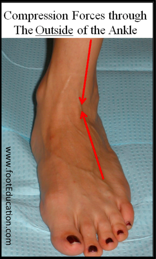 Characteristics of a Flat Foot - FootEducation