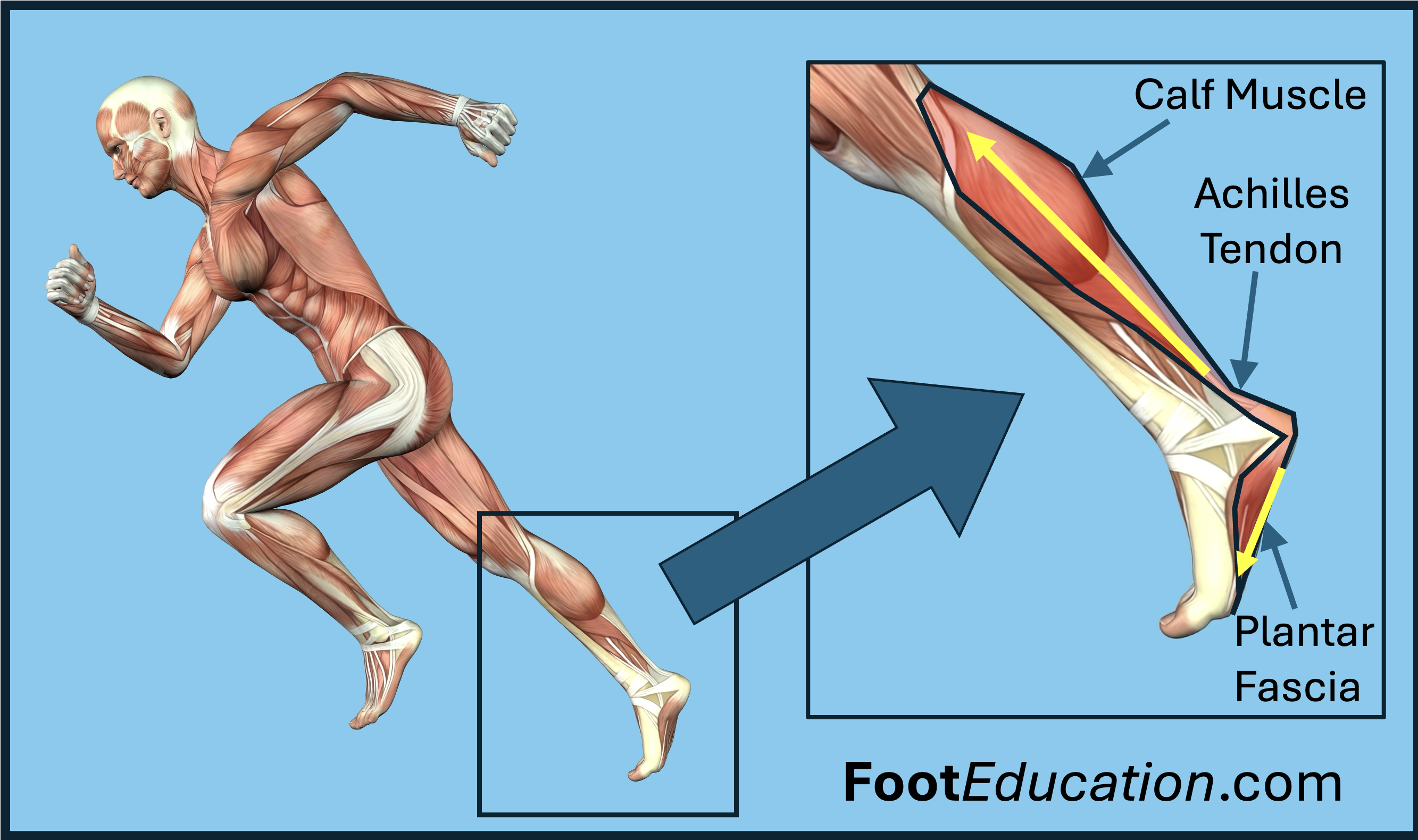 Calf Tears, Achilles Ruptures, Achilles Tendonitis, and Plantar ...